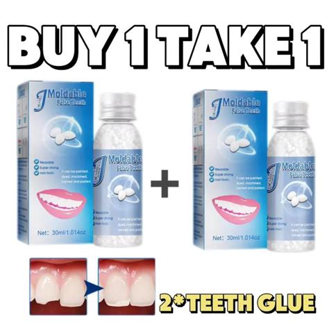 Lst 【buy 1 Take 1】30ml Temporary Tooth Repair Kit Filling Teeth Gaps Moldable False Teeth Solid