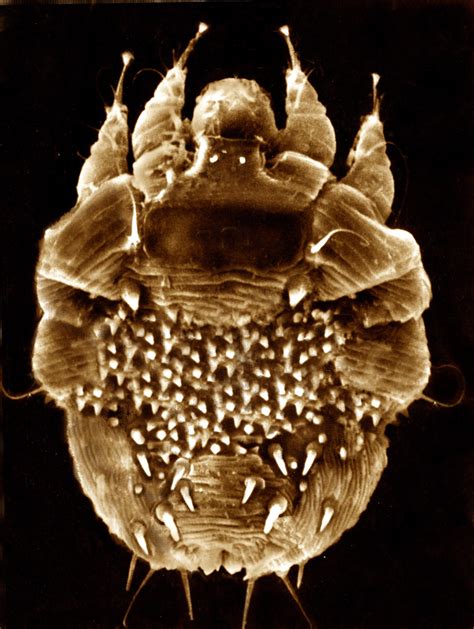 Scabies Under Microscope