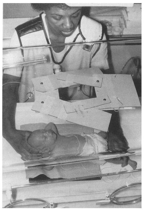 Adjustable Collimator In Position Download Scientific Diagram