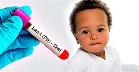 Lead Testing One Year Old At Allen Stark Blog