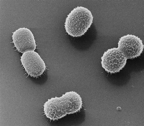 Acinetobacter And Acinetobacter Baumannii Infection Symptoms And Treatment