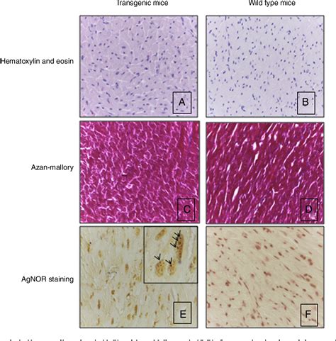 Figure 3 From Hyperdynamic Circulatory Syndrome In A Mouse Model Transgenic For Serpinb3