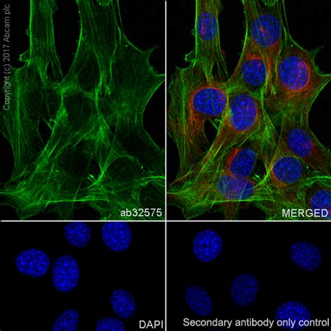 Fibroblast Marker Antibody Panel Human Mouse Ab254015 Abcam