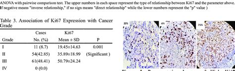 Relation Of Ki67 Expression With Different Parameters In Bc Cases