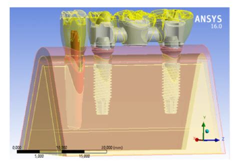 3 D Transparency View Of The Master Model Used For The Experimental Group Download Scientific