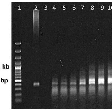 Gradient Pcr Amplification Of Heavy Chain After Temperature Cascade Download Scientific Diagram