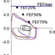 Patient S Flow Volume Loop Demonstrating Abnormalities In The Download Scientific Diagram