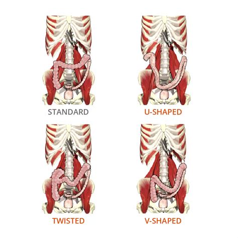Anatomical Variations The Transverse Colon