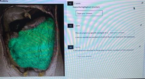 Solved This Structure Is A Specific Example Of A A Serou