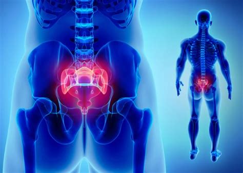 Coccyx Fracture Aftermath And Consequences From Doctor