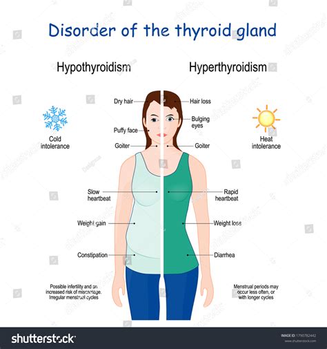 Hyperthyroidism Vs Hypothyroidism