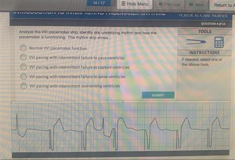 Solved Analyze This Vvi Pacemaker Strip Identify Any