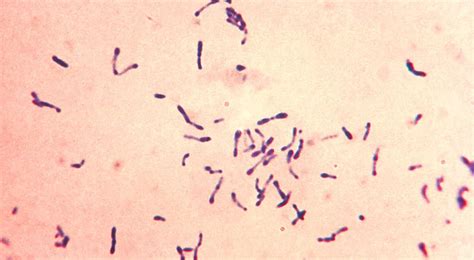 Environmental Isolate Case File Corynebacterium Spp Microbiologics Blog