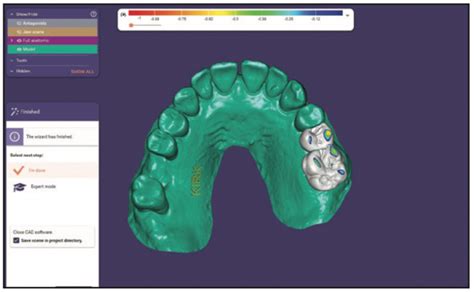 How Digital Dentistry Overcomes Everyday Challenges For Every Dentist