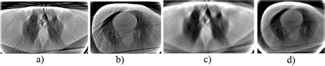 Images Reconstructed With Fbp A B And Lsqr C D Methods Download