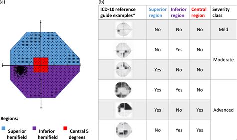 The Icd 10 Glaucoma Severity Score Underestimates The Extent Of