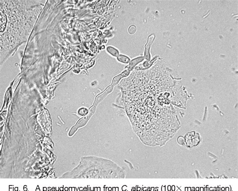 Diagnosis Of Vaginal Discharge By Wet Mount Microscopy A Simple And 1608 Hot Sex Picture