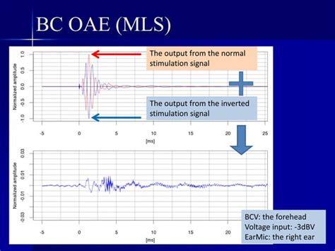 Evaluation Of Techniques For Measuring Distortion Products Of Bone