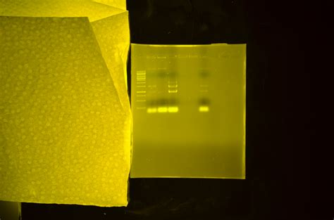 Why Do I Have 4 Distinguishable Bands In My Rna Isolation Researchgate