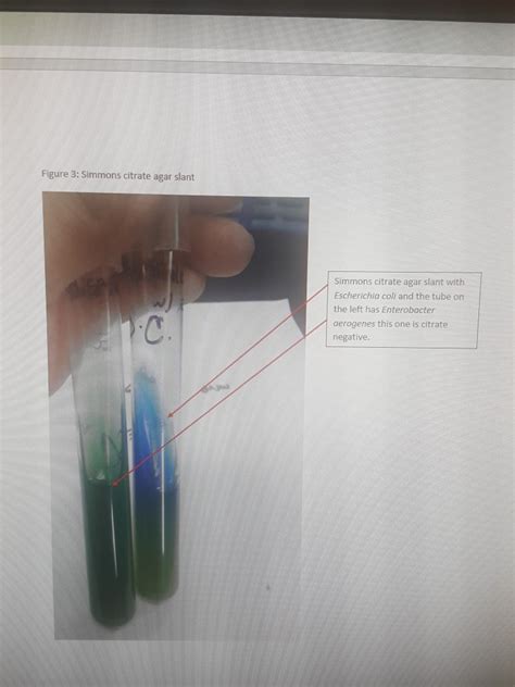 Solved Lab Fermentation PURPOSE This Lab Was To Chegg Com