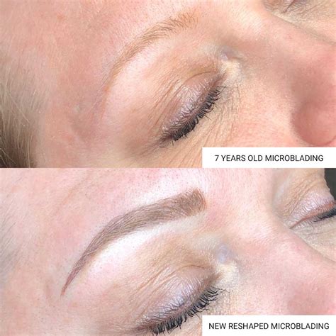 What Happens With Microblading After 5 Years Likely Scenarios And Fixes