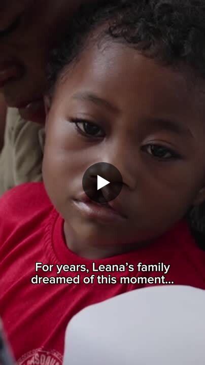 Cleft Cleftlip Cleftpalate Operationsmile Operationsmileuk