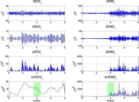 The Process Of EEG And EMG Signal Transformation In A Single Trial For Download Scientific