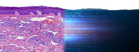 A New Algorithm Classifies Different Types Of Sarcoma IDIBELL