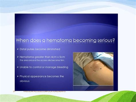 Vascular Access In Cardiac Catheterization Ppt