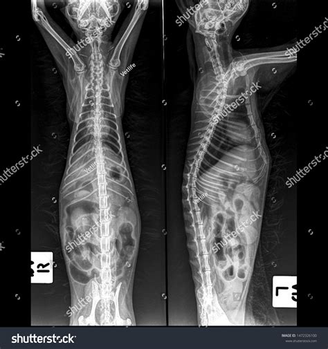 Pneumonia In Cats X Ray Laquanda Caudill