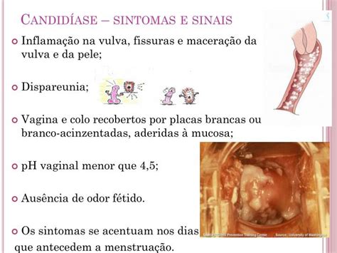 Ppt Vulvovaginites Powerpoint Presentation Id 3447738