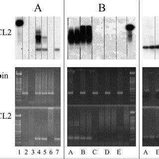 An Example Of Nested Polymerase Chain Reaction PCR Analysis For Download Scientific Diagram
