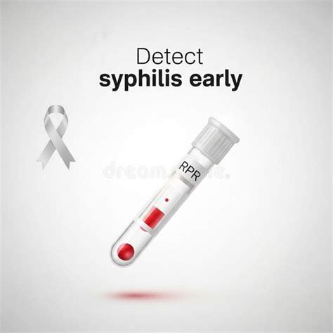 Early Screening For Syphilis Using The Rpr Test Stock Illustration