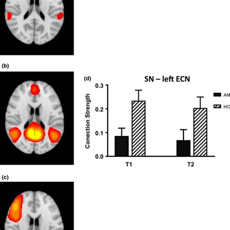 Functional Connectivity Analysis Shows Reduced Connectivity Between The Download Scientific