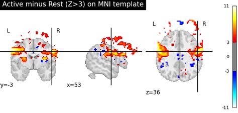 Steps For Smooth Ica Implementation In Fmri Neuroimaging Neurostars