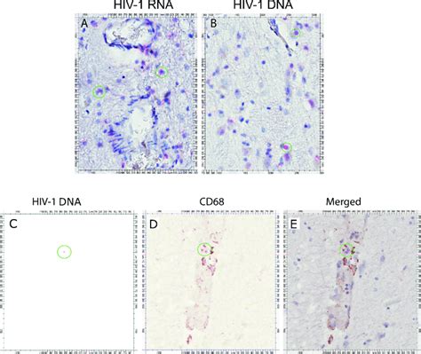 Rna Dnascope In Situ Hybridization For Hiv 1 Rna And Dna Detection A