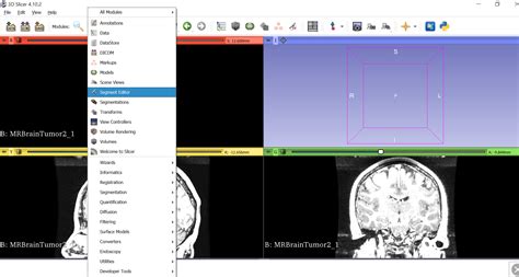 Everything Modelling And Simulation Medical Image Segmentation With 3d Slicer A Beginners Guide