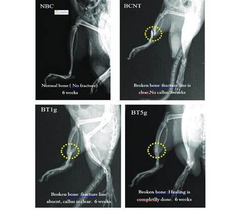 X Ray Photo After 6 Weeks Of Tibial Fracture Induced In Male Albino Download Scientific Diagram