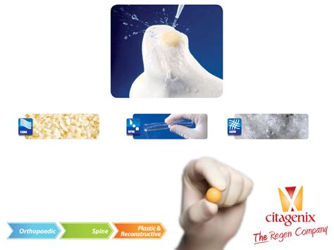 Demineralized Bone Matrix Dbm Citagenix Inc