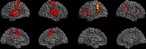 Resting State Functional Connectivity Maps For The Left Planum Download Scientific Diagram