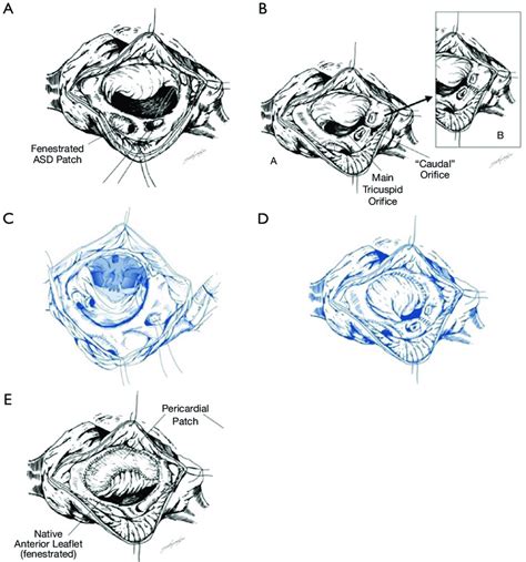 Knott Craig Monocusp Technique Download Scientific Diagram