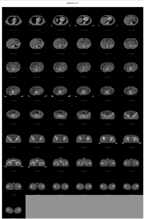 使用monaivisualizeutilsmatshow3d函数展示3d医学图像matshow3d参数 Csdn博客