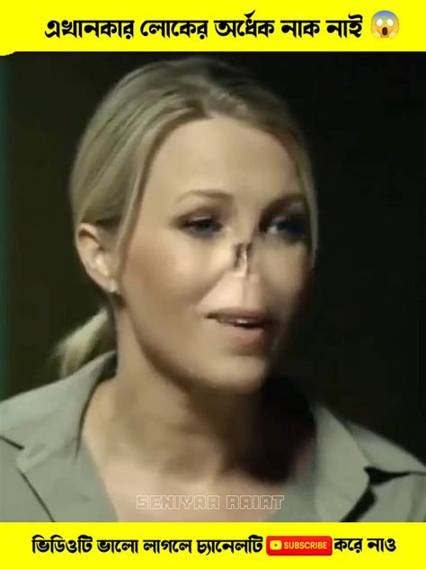 এখানকার লোকের অর্ধেক নাক নাই 😱 Shorts Shortsfeed Youtube