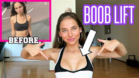 Breast Lift Workout Before After Kmkvpv