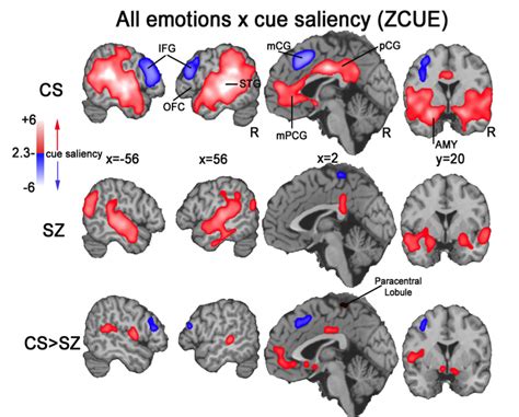 Multimodal Neuroimaging Of Prosody Applied Social Neuroscience And Perception Laboratory