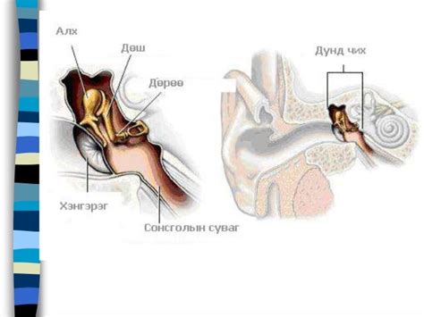Дунд чихний архаг үрэвсэл