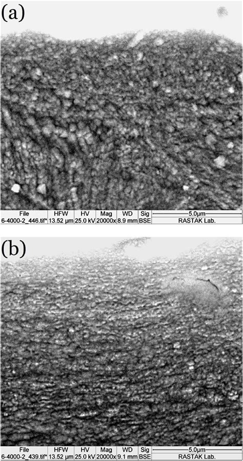 Comparison Of Conventional And Severe Shot Peening Effects On The Microstructure Texture