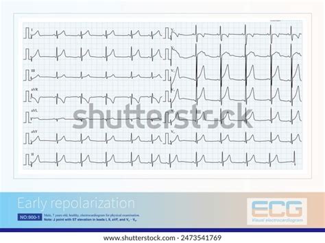 Polymorphism Action Photos Images And Pictures Shutterstock