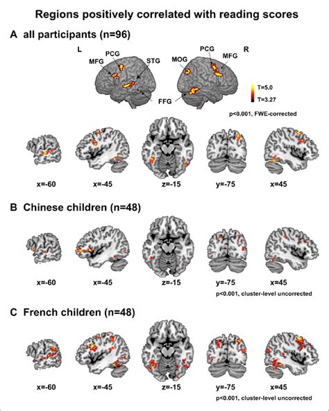 Neural Correlates Of Inter Individual Variability In Reading Scores Download Scientific