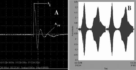Waveform For A Free And B Forced Vibration Download Scientific Diagram